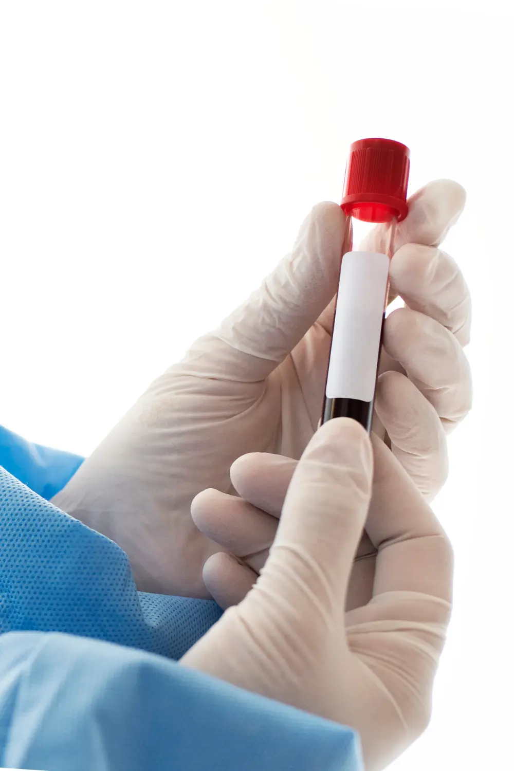 Blood Test for Dogs – Happy Paws Vet